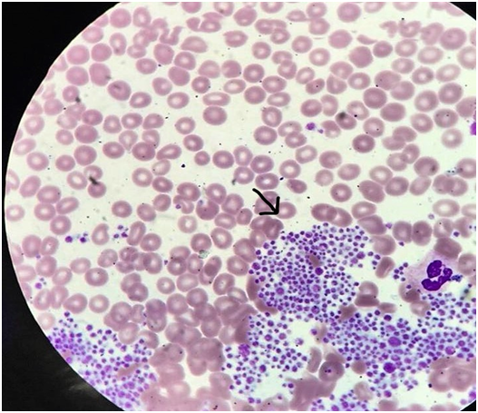 Hematologia Clínica : Atlas de Hematologia