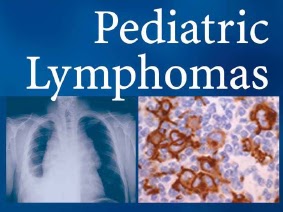Pediatric Lymphomas - All About Cancer
