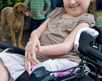 Pengertian Atrofi - Focus Health and Medical