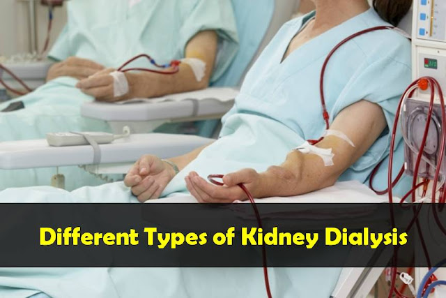 Different Types of Kidney Dialysis