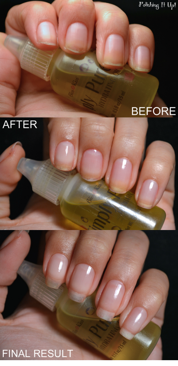 Polishing It Up!: Nail Growth Progress!! Loving Bliss Kiss Oil.