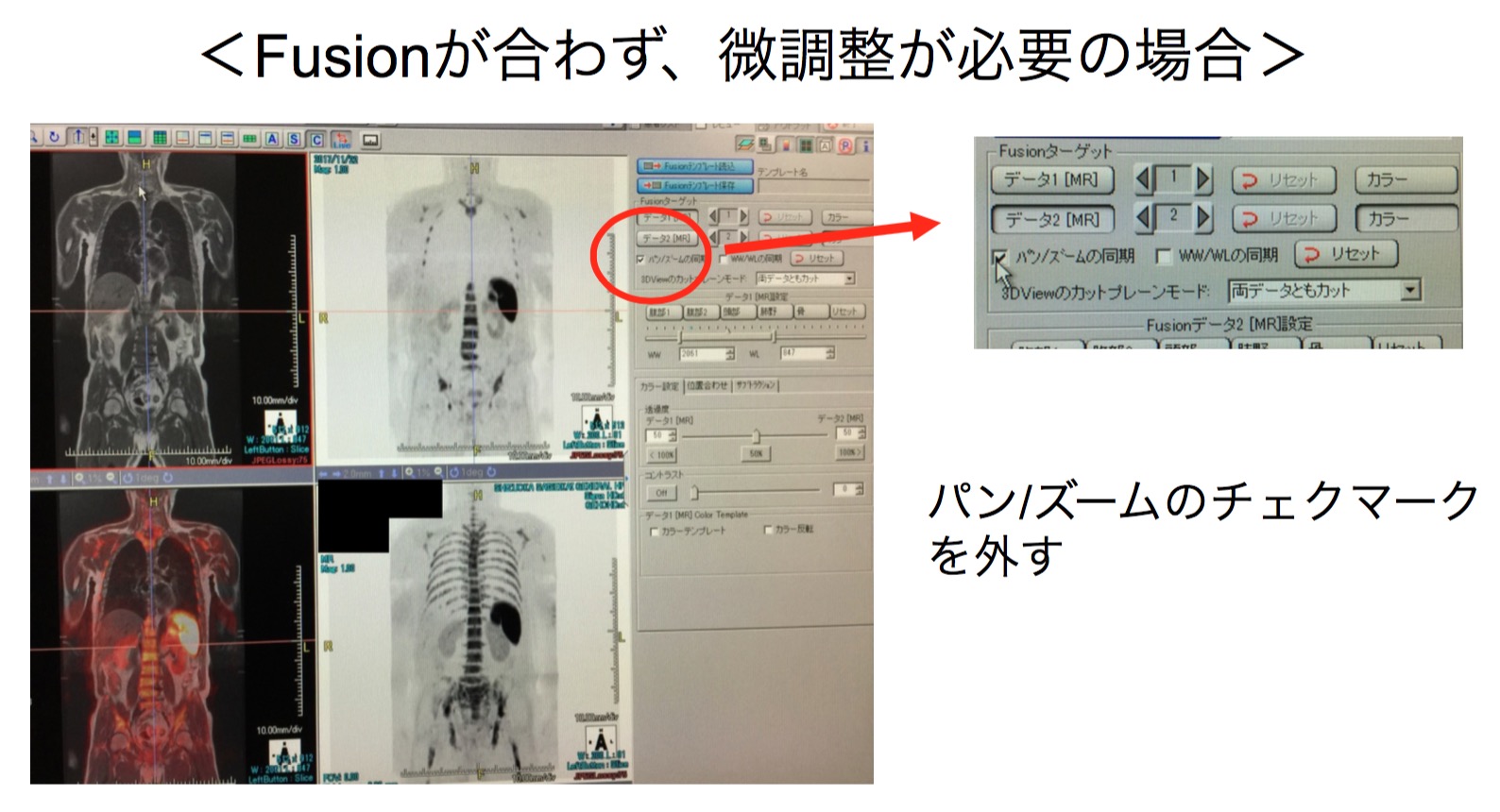 GE DWIBS研究会: アクエリアスネットによるDWIBS・Fusion法