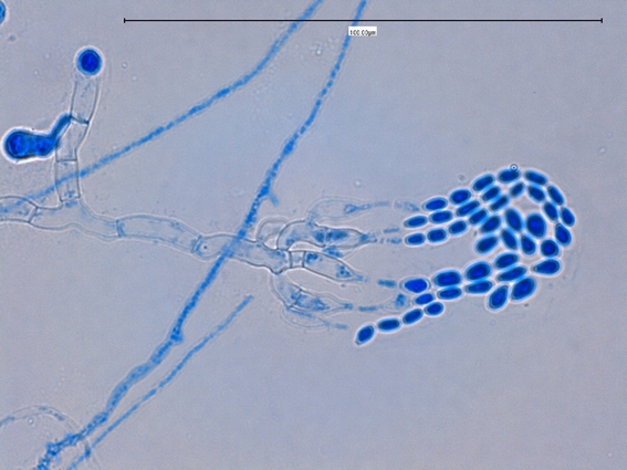 Fun With Microbiology (What's Buggin' You?): Arthrographis species