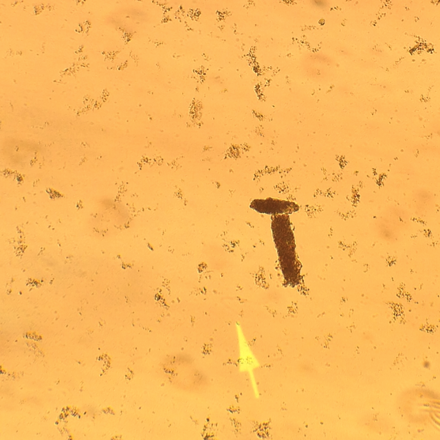 Medicine, 4 log units above normal! – Precious Bodily Fluids