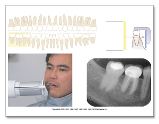 Dentistry and Medicine: Intraoral Radiographic Techniques (Paralleling ...
