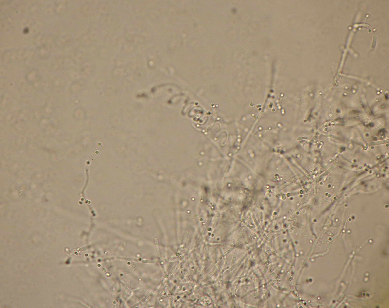 ATLAS MICOLOGIA: TRICHOPHYTON MENTAGROPHYTES