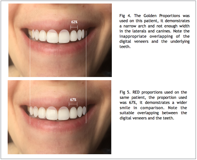 Dr. Mohanad's Dental Blog: Esthetic Dental Proportions