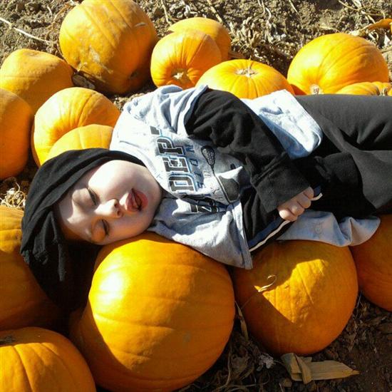 ΣΥΓΚΛΟΝΙΣΤΙΚΟ - Η ιστορία του μικρού Nickolas Coke που γεννήθηκε χωρίς ...