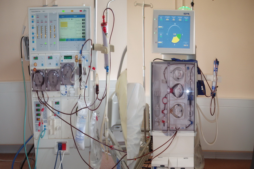 TPE 2012 - 2013 : Dans quelles mesures la dialyse peut-elle remplacer ...