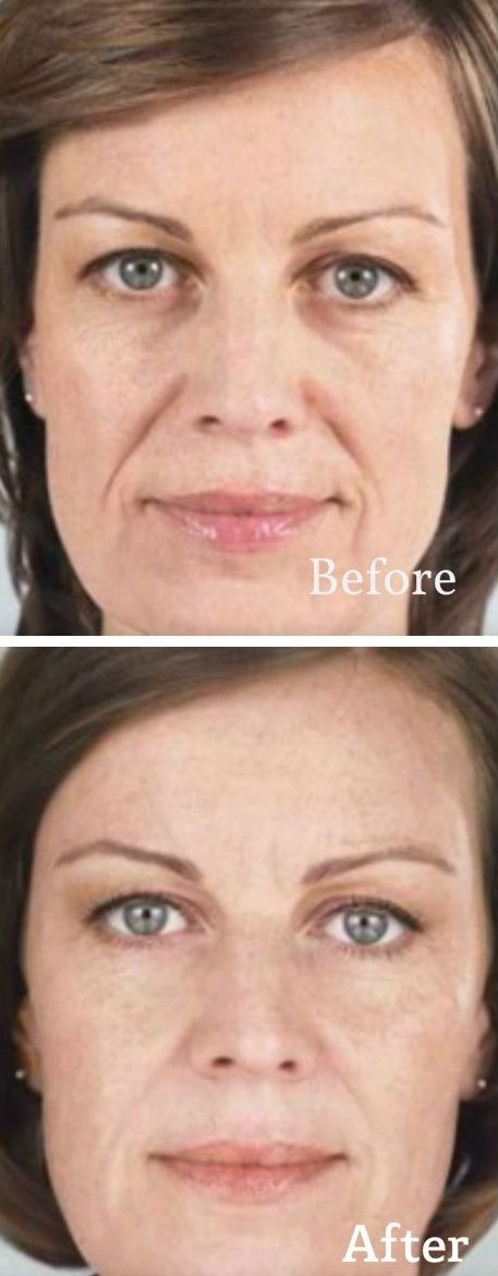 Facial Yoga Workouts To Tone And Tighten Face Tissue And Muscle ...