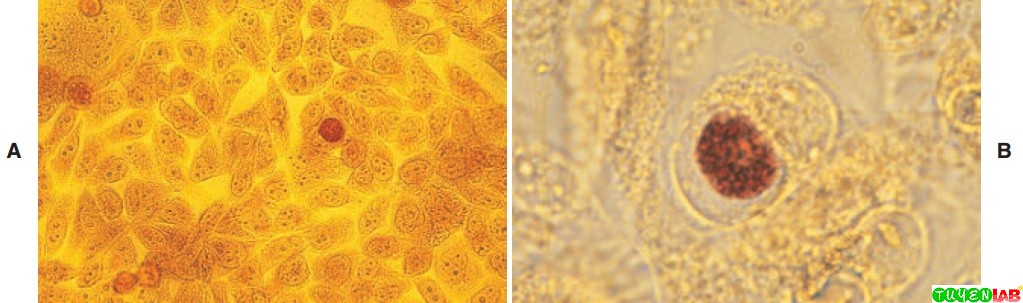 [Microbiology] Atlas of The Spirochetes, Chlamydia and Rickettsia ...