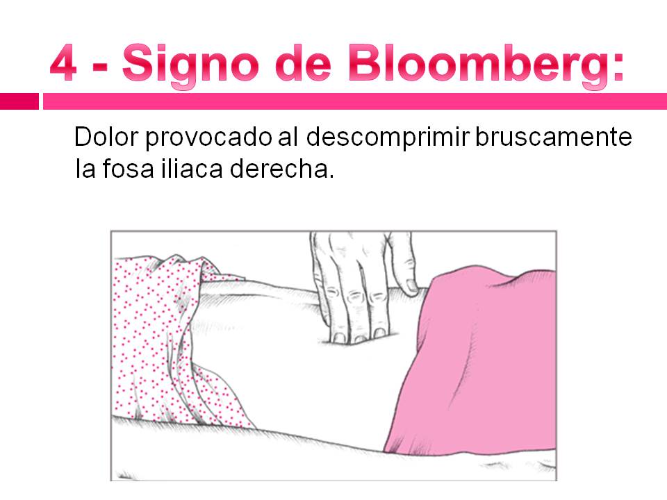 Retroalimentación médica: Apendicitis aguda - Apendicectomía Laparoscópica