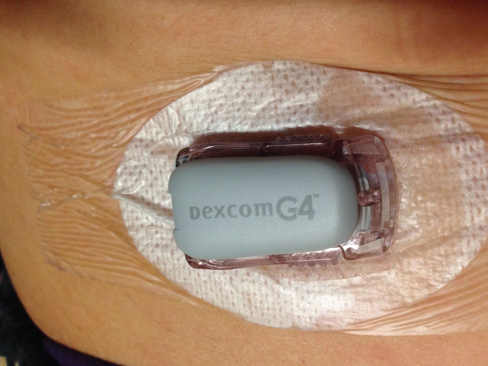 A life of Sparkles and Sugar : Dexcom