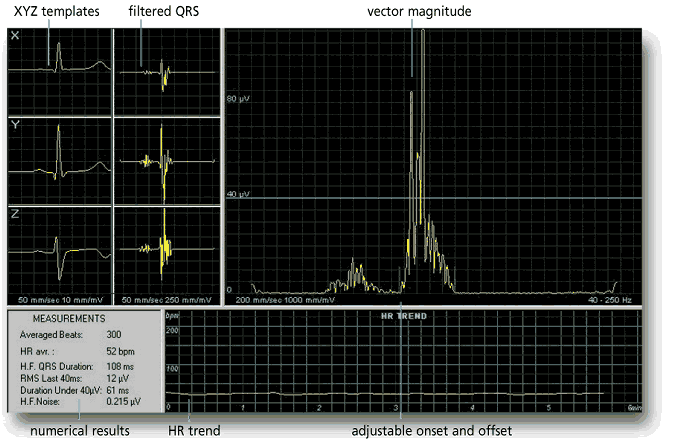 ΓΙΑΝΝΟΠΟΥΛΟΣ ΝΙΚΟΛΑΟΣ ΚΑΡΔΙΟΛΟΓΟΣ ΚΑΡΔΙΟΛΟΓΙΚΟ ΙΑΤΡΕΙΟ ΧΑΙΔΑΡΙ: Όψιμα ...
