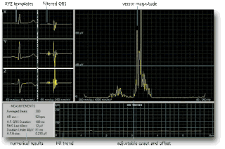 ΓΙΑΝΝΟΠΟΥΛΟΣ ΝΙΚΟΛΑΟΣ ΚΑΡΔΙΟΛΟΓΟΣ ΚΑΡΔΙΟΛΟΓΙΚΟ ΙΑΤΡΕΙΟ ΧΑΙΔΑΡΙ: Όψιμα ...