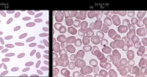 All you need to know