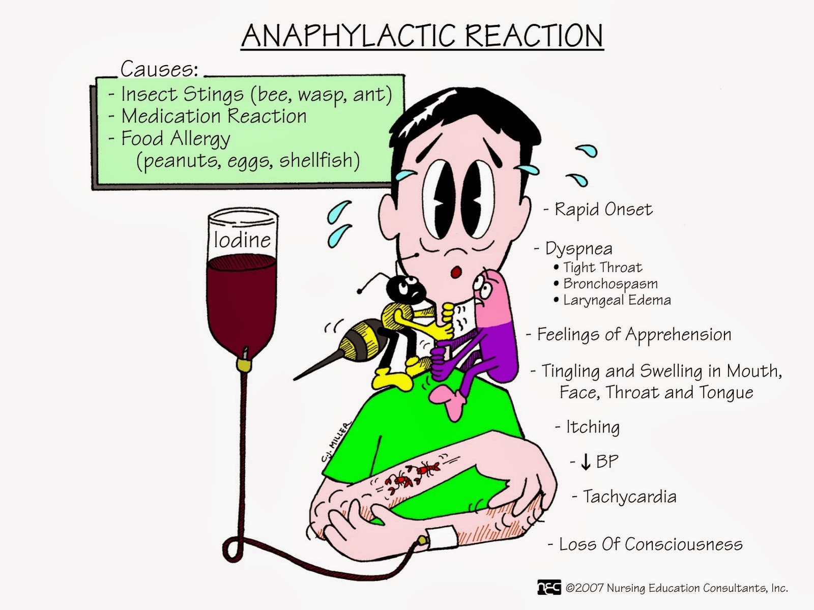 Nurses Notes: MS NURSING MNEMONICS