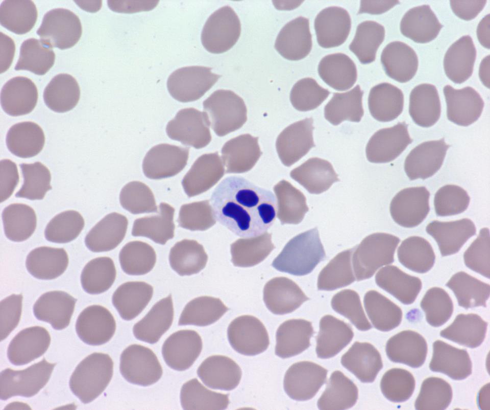 VETERINARY HEMATOLOGY DEXTERVET: pyknotic cell it was most likely a ...