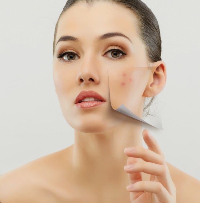 HEALTHY LIVING: HOW TO GET RID OF PIMPLES FAST
