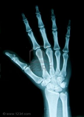 Rayos X [1981] - climateprogs