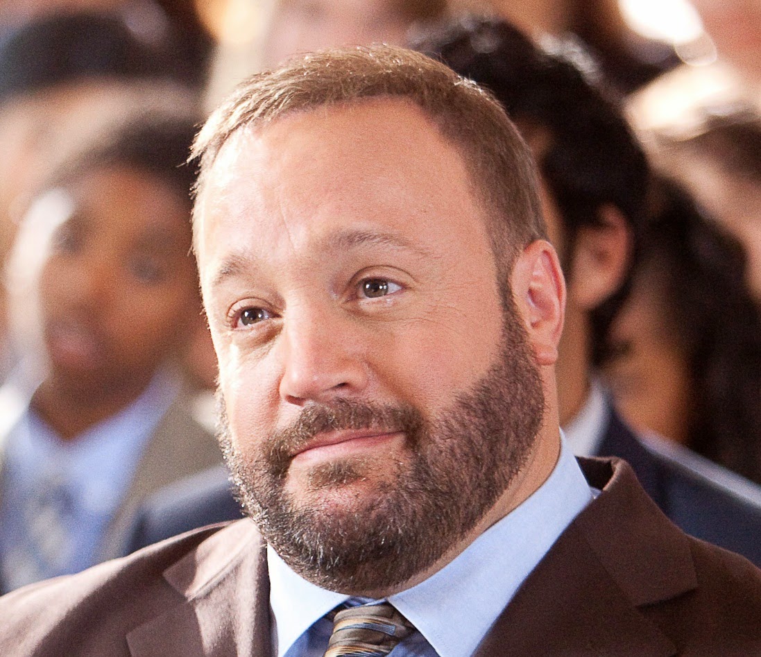 Kevin James Hair Transplant