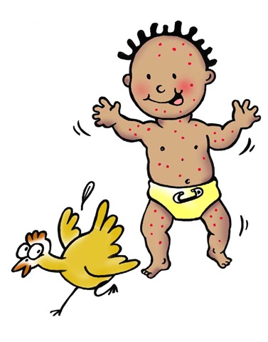 Chicken Pox - Type Animal