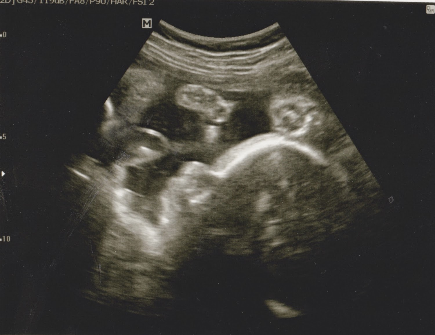 32 Weeks Pregnant and Last Ultrasound Visit! - The Journey of Parenthood...
