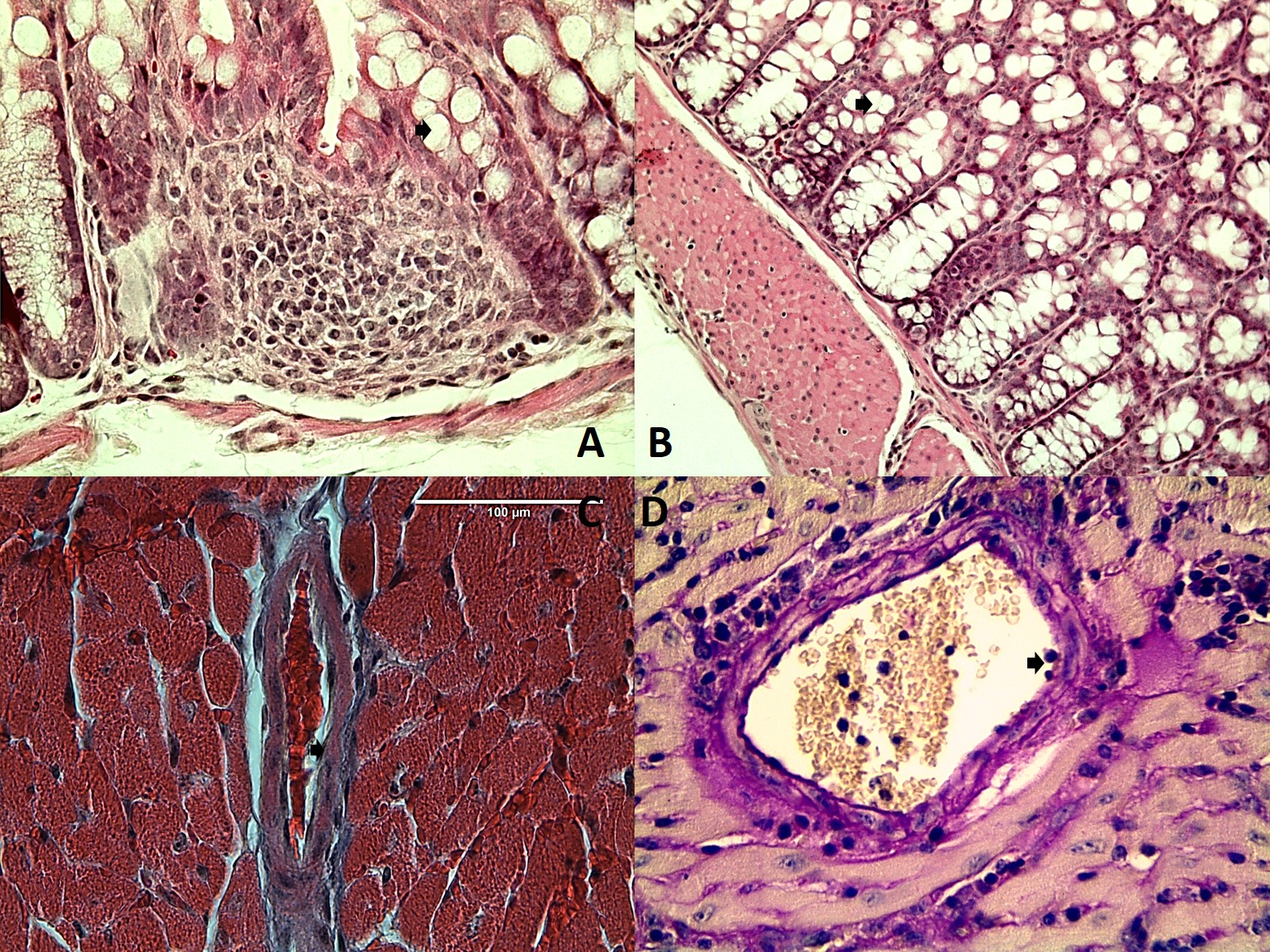 Morfología celular: células caliciformes y planas.
