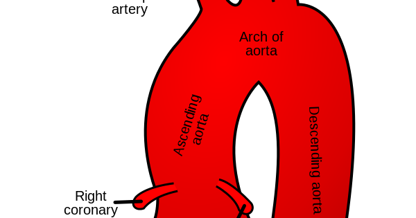 Just Breathe: Aortopexy