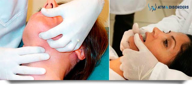 Trastorno Temporomandibular ATM - ATM y Bruxismo