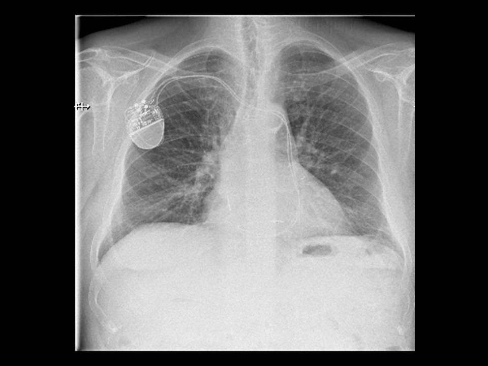 Casos de radiología de la Clínica Universidad de Navarra: Caso 225