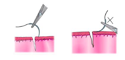 Every Details about Oral Surgery: How to suture wound tissue?? - Ten ...