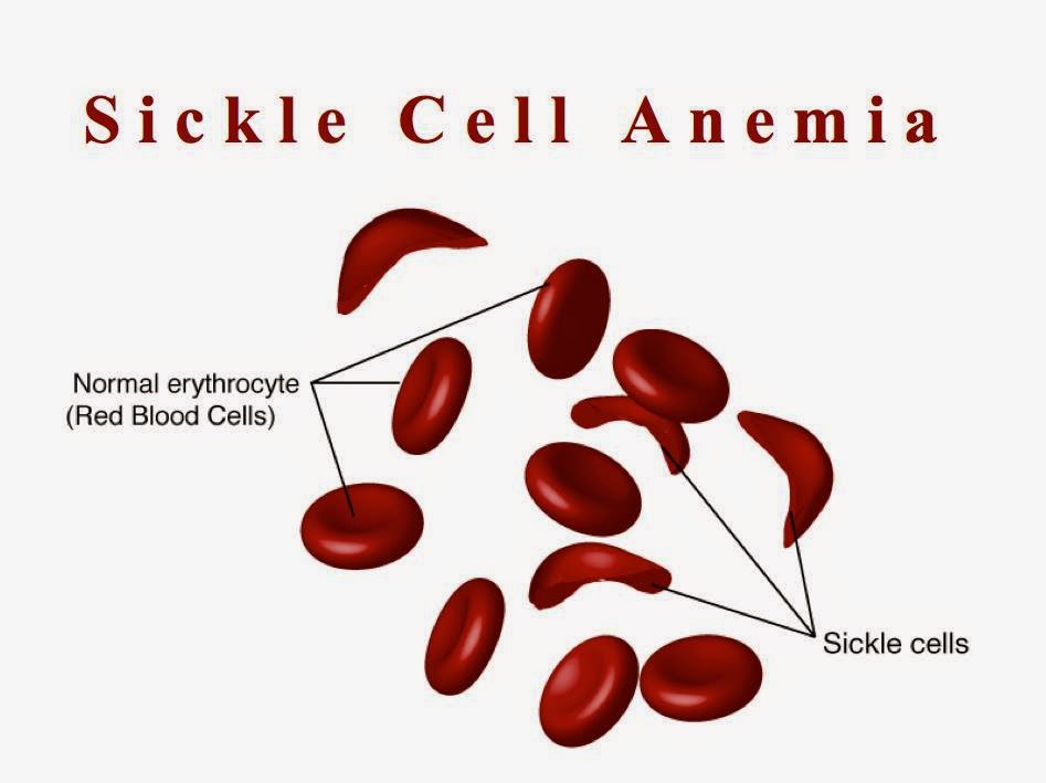 KeeperofStories: HEALTH ISSUES specific to the darker hue