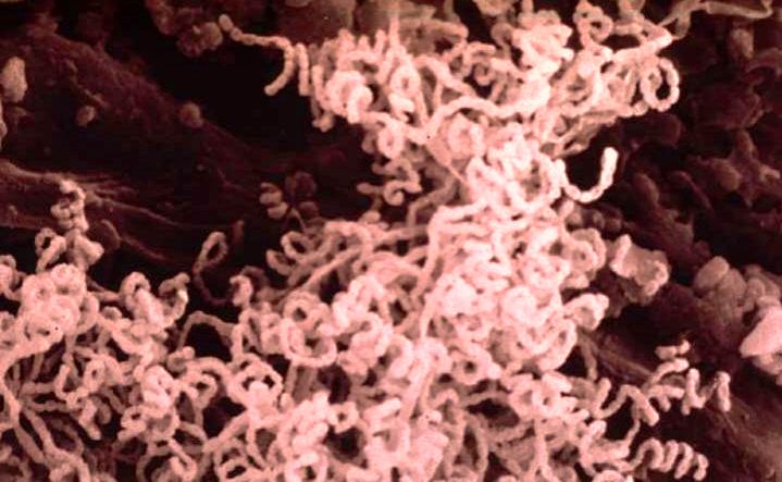 What is Actinomycetes? - Microbes World