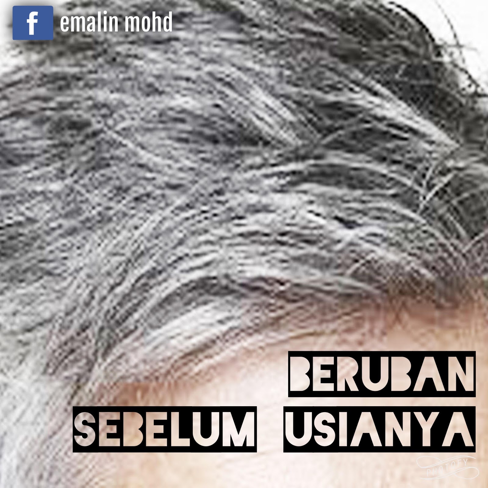 Rambut Beruban Sebelum Tua. Apa Nak Buat? - Healthy is a Lifestyle