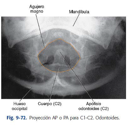 PRODUCCION Y TRATAMIENTO DE IMAGENES DIAGNOSTICAS: CAPITULO COLUMNA ...