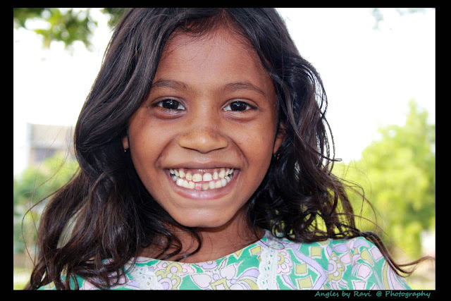 THE RIGHT ANGLE: the true smile