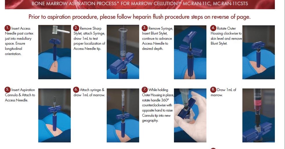Lecture Notes in Medical Technology: Lecture # 15: Bone Marrow Examination