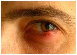 TODO SOBRE SEMIOLOGIA QUIRURGICA: SEMIOLOGIA DE LA CARA Y SUS ADORNOS