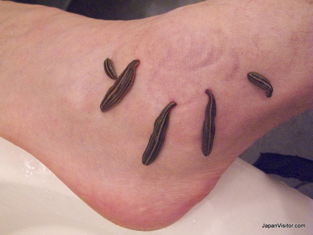 AQUA DOC Lake and Pond Management: Leeches Suck!