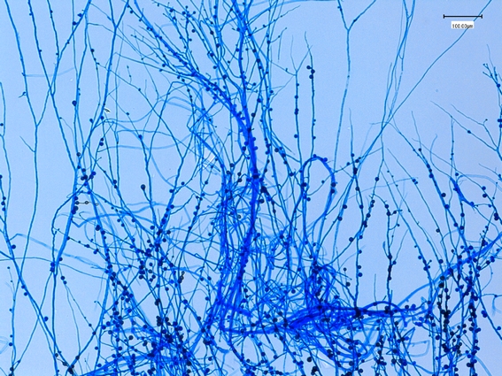 Fun With Microbiology (What's Buggin' You?)