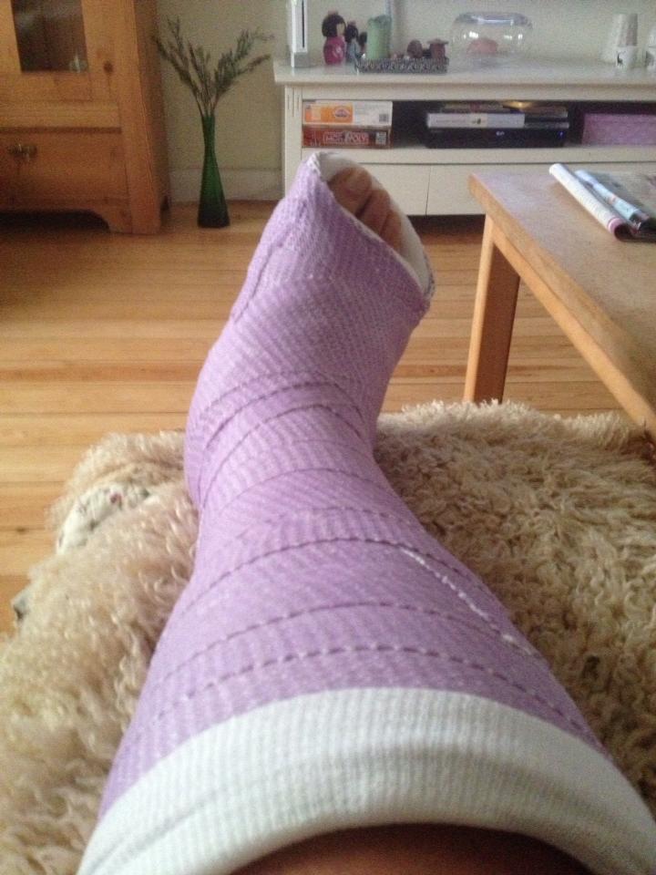 Dorthesliv: C D og gipsben :)