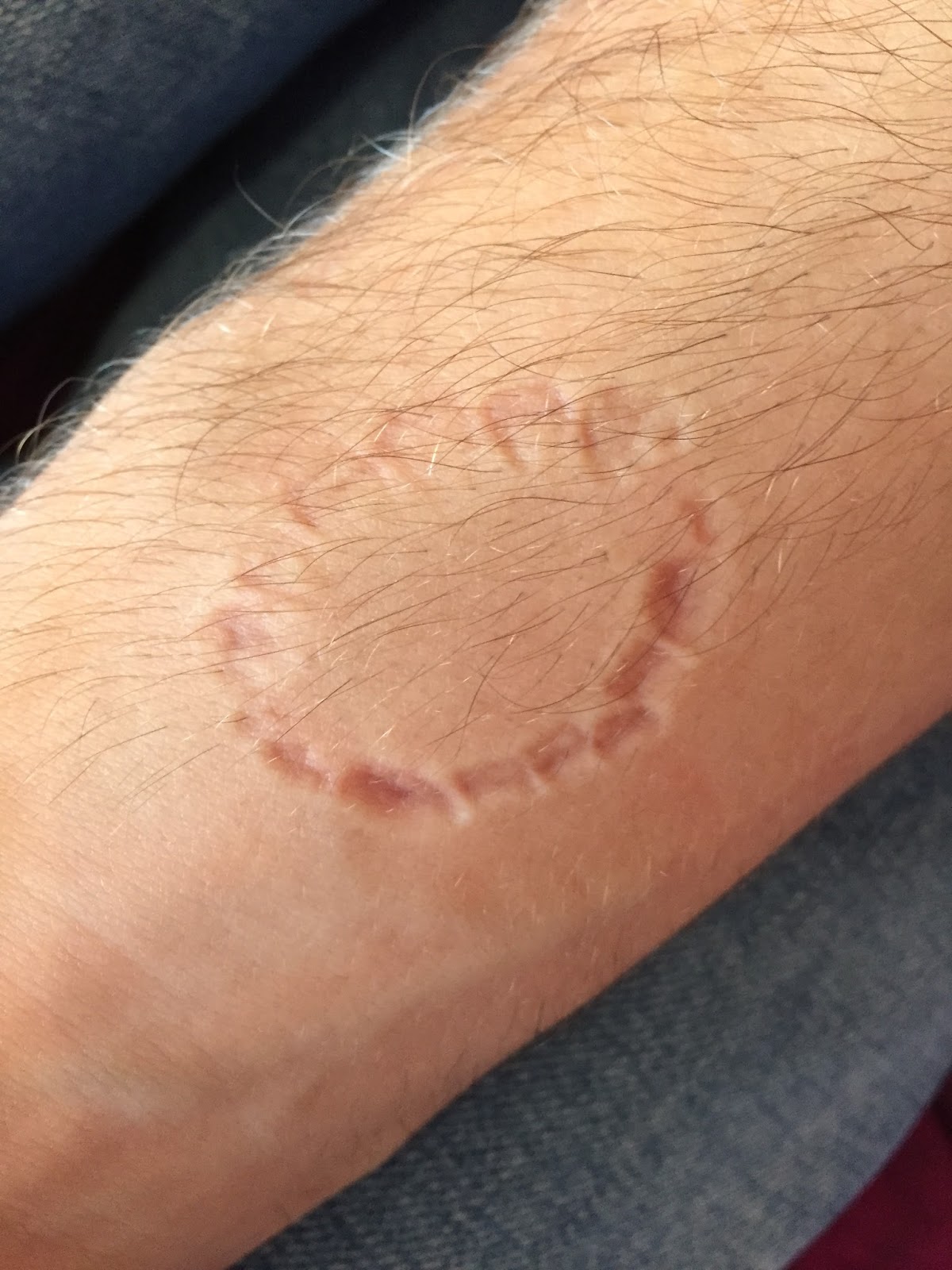 Special Effects - Brave New World: Looking into Human Bite Marks