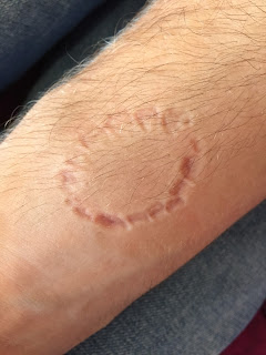 Special Effects - Brave New World: Looking into Human Bite Marks