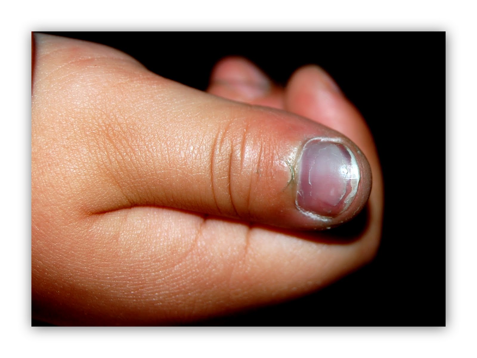 As Aventuras da Maternidade: Junho 2011