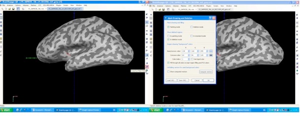 Neuroimaging Made Easy : Brainvoyager QX tips and tricks 1; Some ...