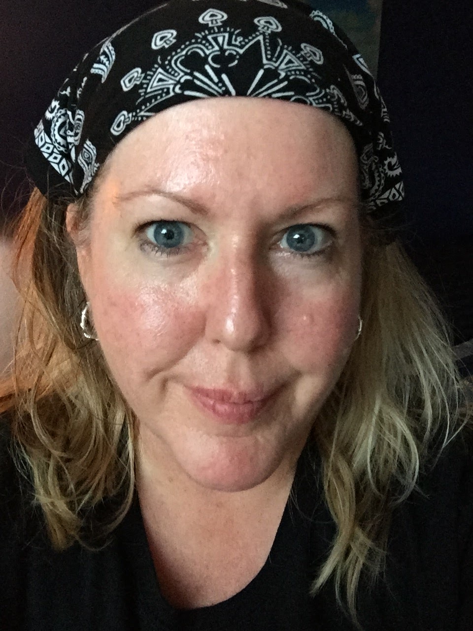 My Journey Through Topical Chemotherapy - Fluorouracil 5% Cream and ...