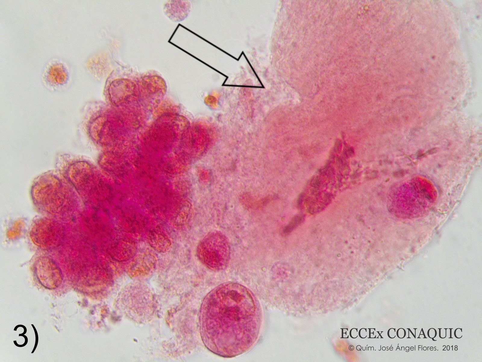 Examen General de Orina: 2018