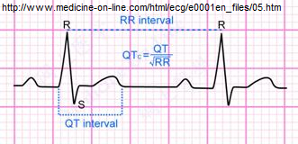 Qtc Calculator 外観の紹介