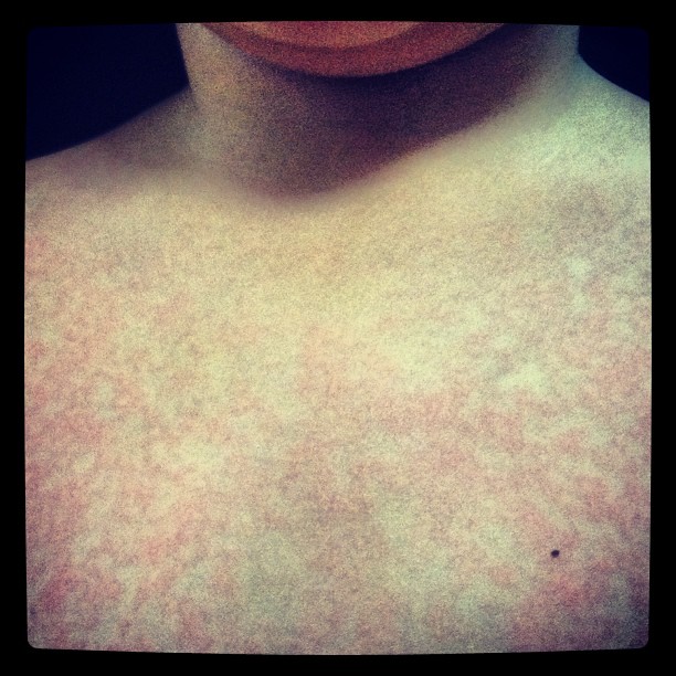 an attempt to remain sane in this insane world...: Recovery and Restoration